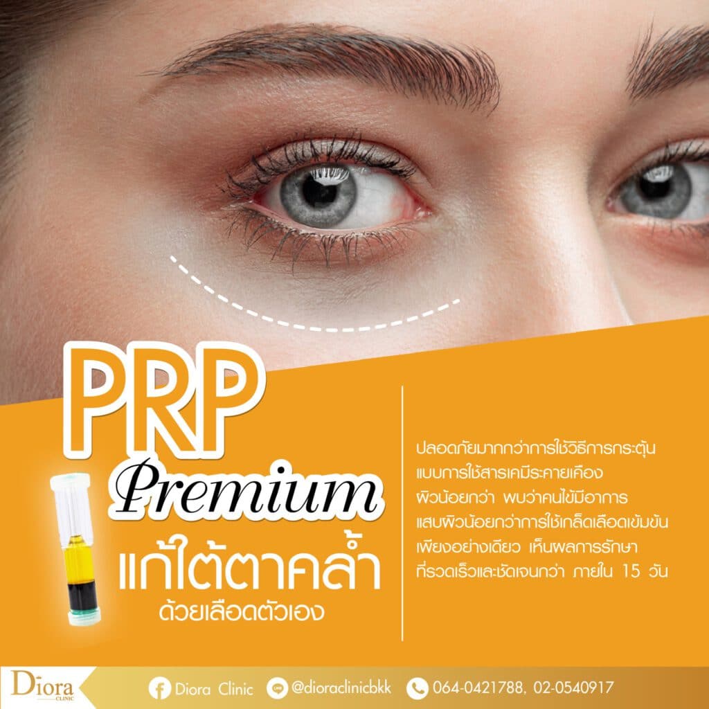 PRP Premium - Diora Clinic