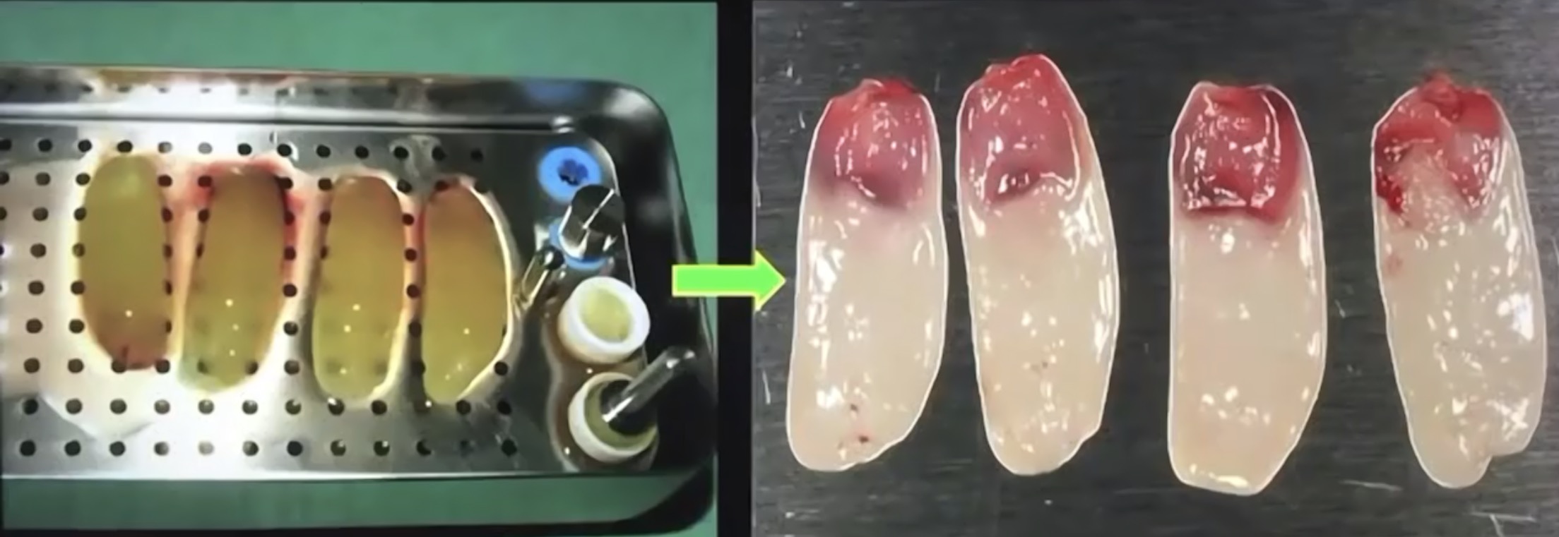 plasma gel biofiller คือ อะไร ?? - Diora Clinic