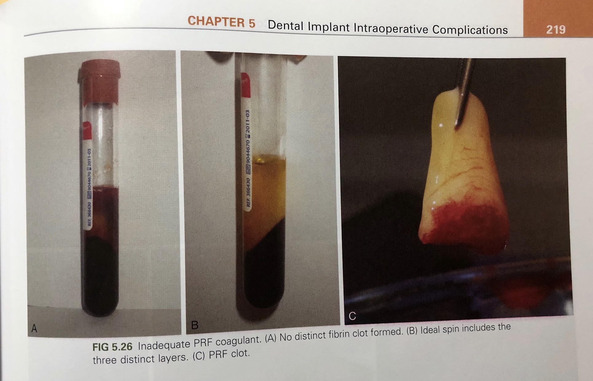 Biofiller Plasma Gel - Diora Clinic